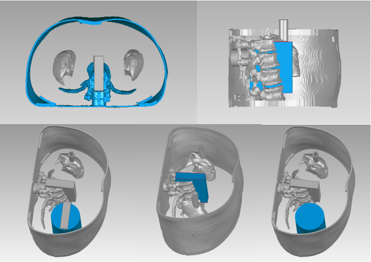 Thorax/Abdomen - RTsafe